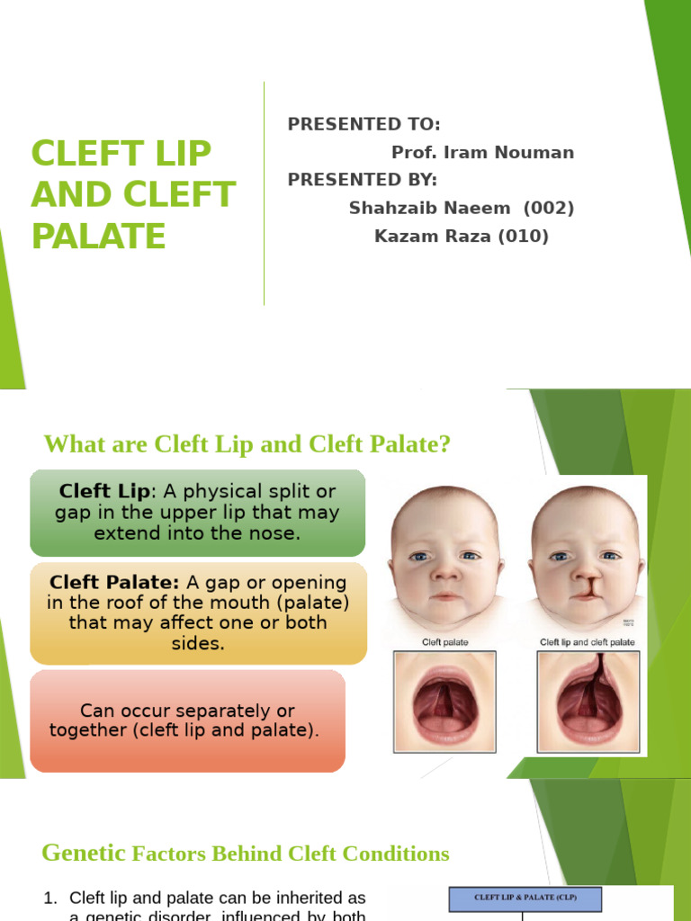 Cleft Lip and Cleft Palate | PDF | Genetic Disorder | Human Diseases ...