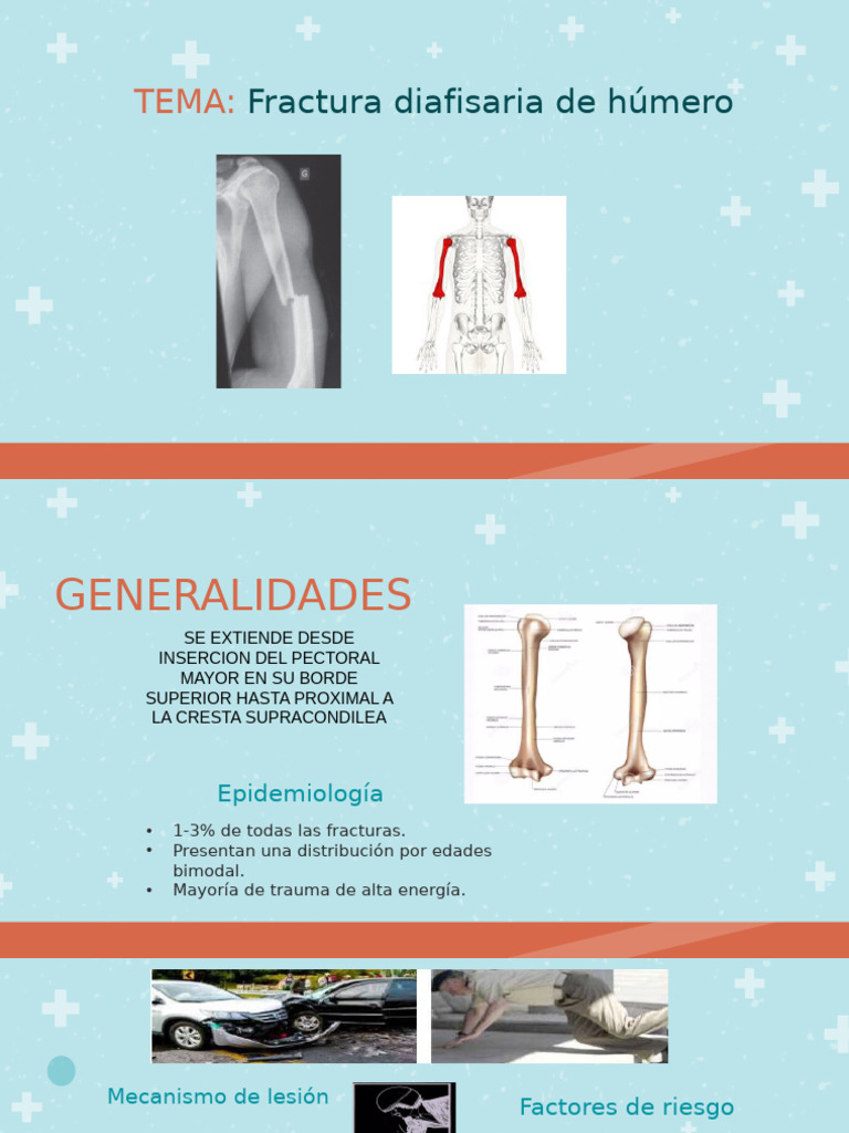 Traumato - FX Diafisis Humero | PDF | Hueso | Codo