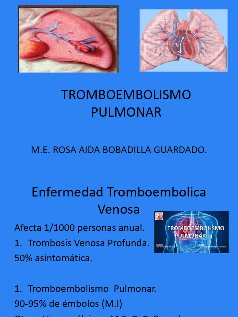Tromboembolismo Pulmonar | PDF | Trombo | Especialidades Medicas