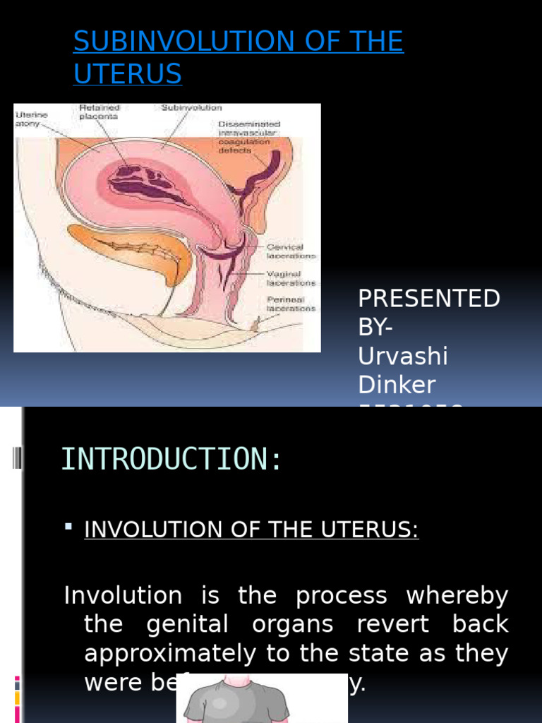 Subinvolution of Uterus (1) Final | PDF | Thrombosis | Medical Specialties