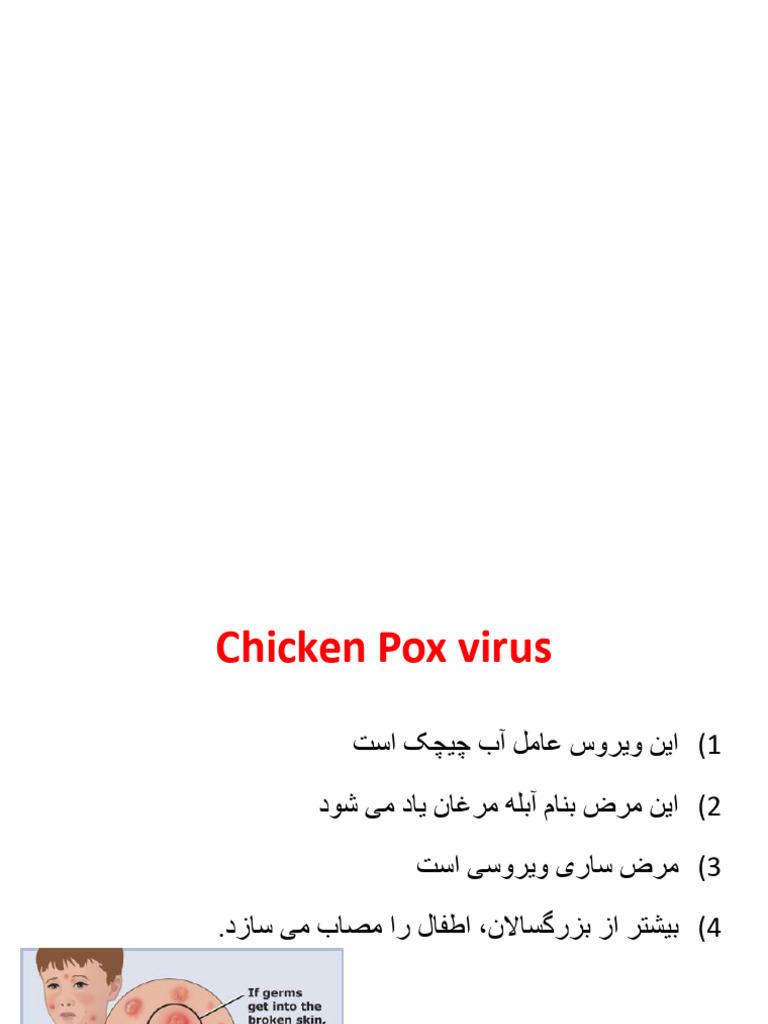 Chicken Pox | PDF