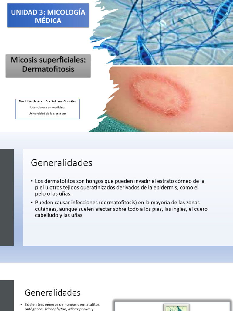 Dermatofitosis: Micosis Superficiales y Epidemiología | PDF | Hongo ...