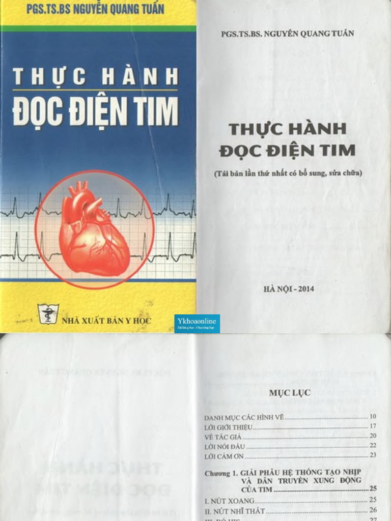 Thực Hành Đọc Điện Tim | PDF