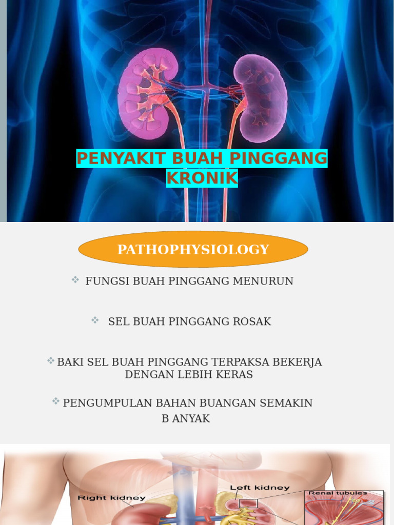 Chronic Kidney Disease | PDF