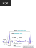 Abnormal ECG Findings in Athletes: Seattle Criteria | PDF ...