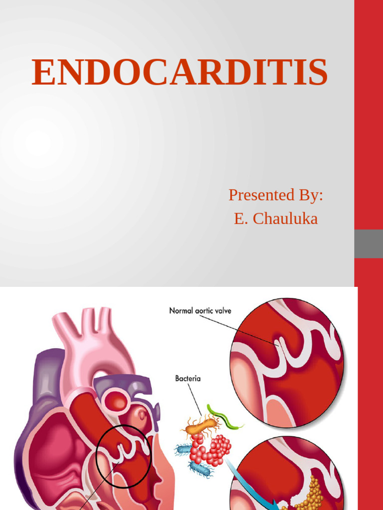endocarditis | PDF | Heart | Ischemia