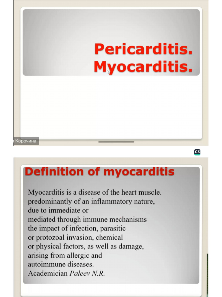 Pericarditis. Myocarditis | PDF