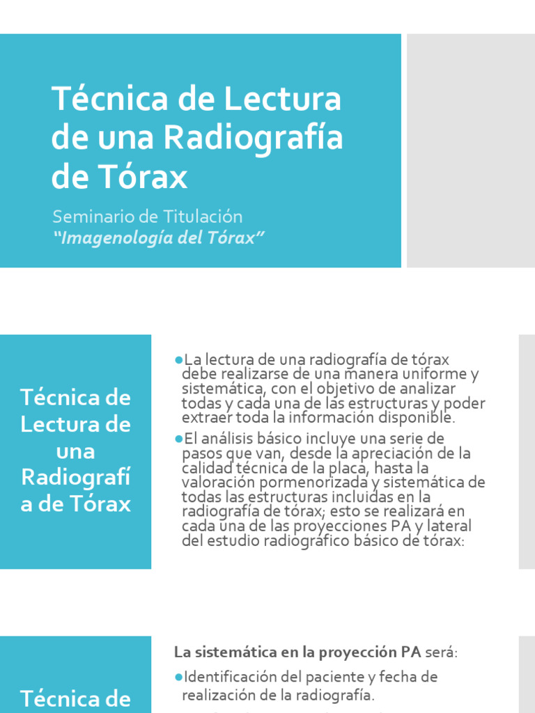 04 Técnica de Lectura de Una Radiografia de Torax | PDF | Tórax | Pulmón