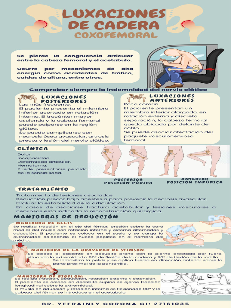 Luxación de Cadera Yefrainly | PDF | Sistema musculoesquelético | Anatomía del miembro inferior