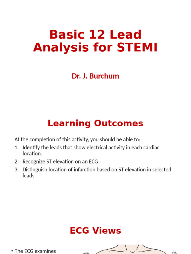 12 Lead ECG Analysis For STEMI (1) - Tagged | PDF | Electrocardiography | Visual Cortex