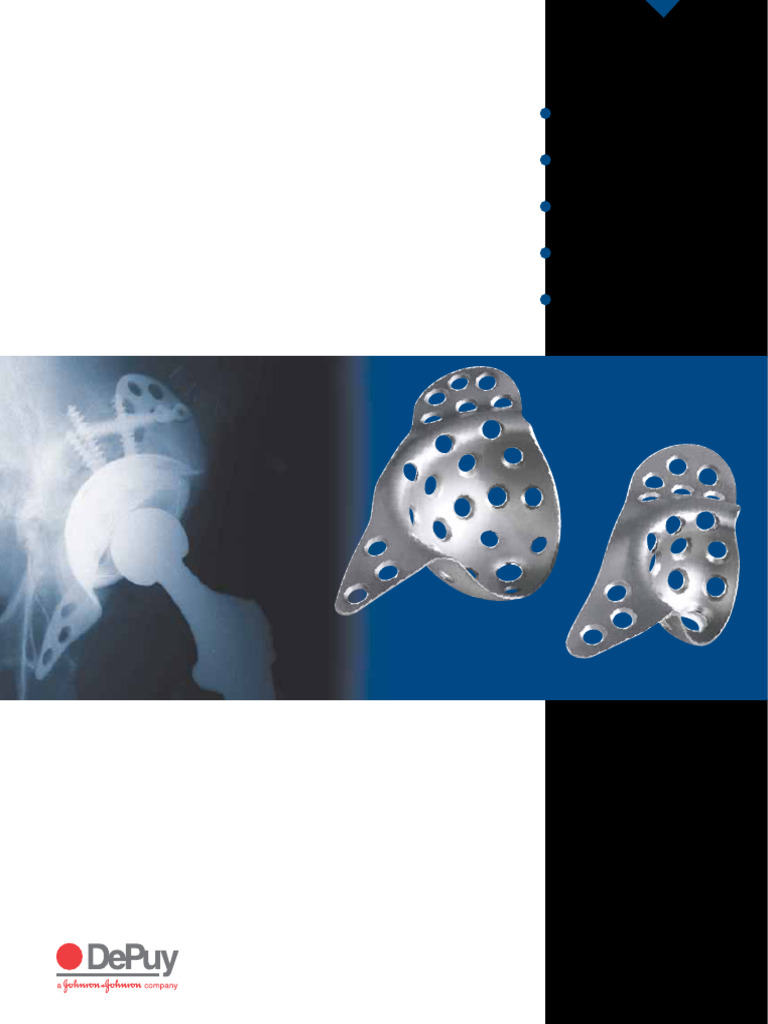 DPY Protrusio Cage Surgical Technique 0611-12-050r2 | PDF | Implant ...