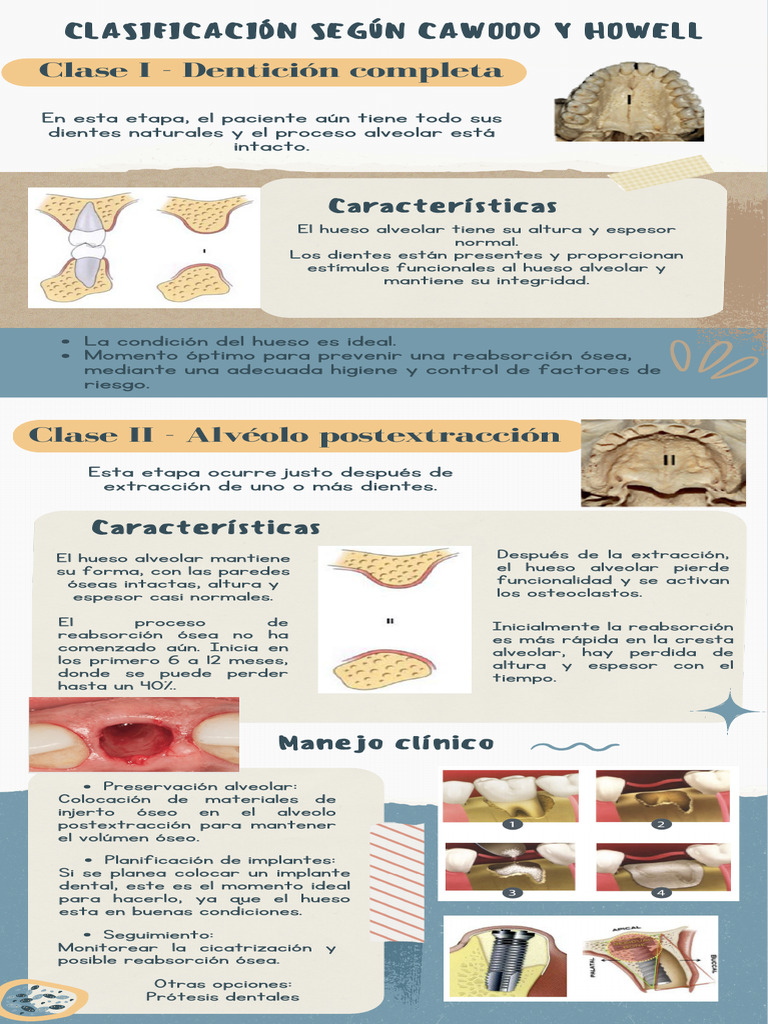 Clasificación de Cawood y Howell | PDF