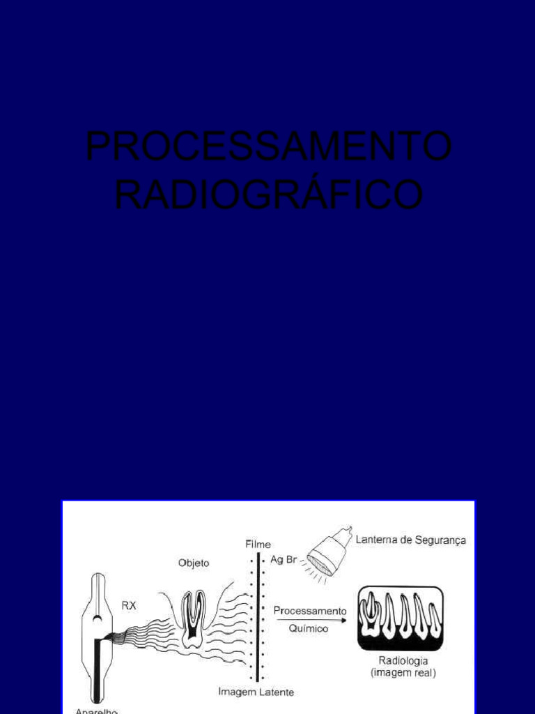 Aula 2 Processamento Radiográfico | PDF | Substancias químicas | Materiais