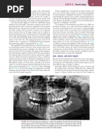 Panoramic Radiograph Interpretation Guide | PDF | Dental Anatomy ...