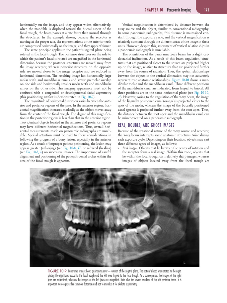 Real Image Double Image Ghost Image | PDF | Radiography