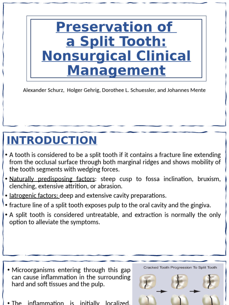 Preservation of Split Tooth | PDF | Dental Anatomy | Tooth