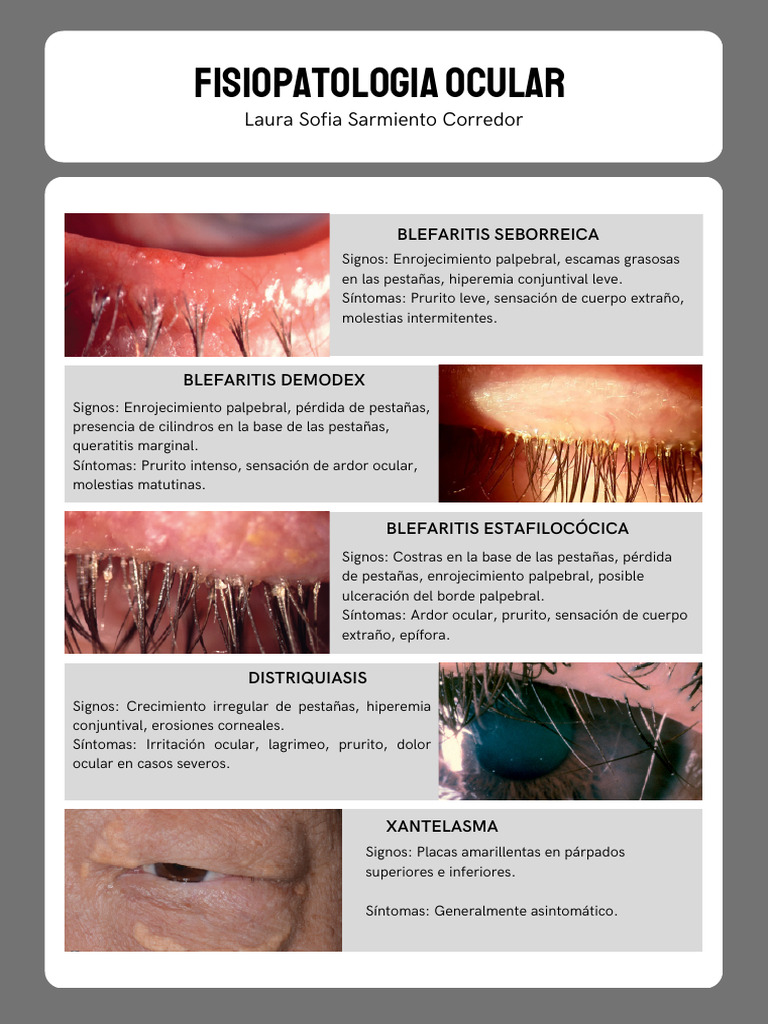 Fisiopatologia Ocular. Producto 1 PDF | PDF | Oftalmología ...
