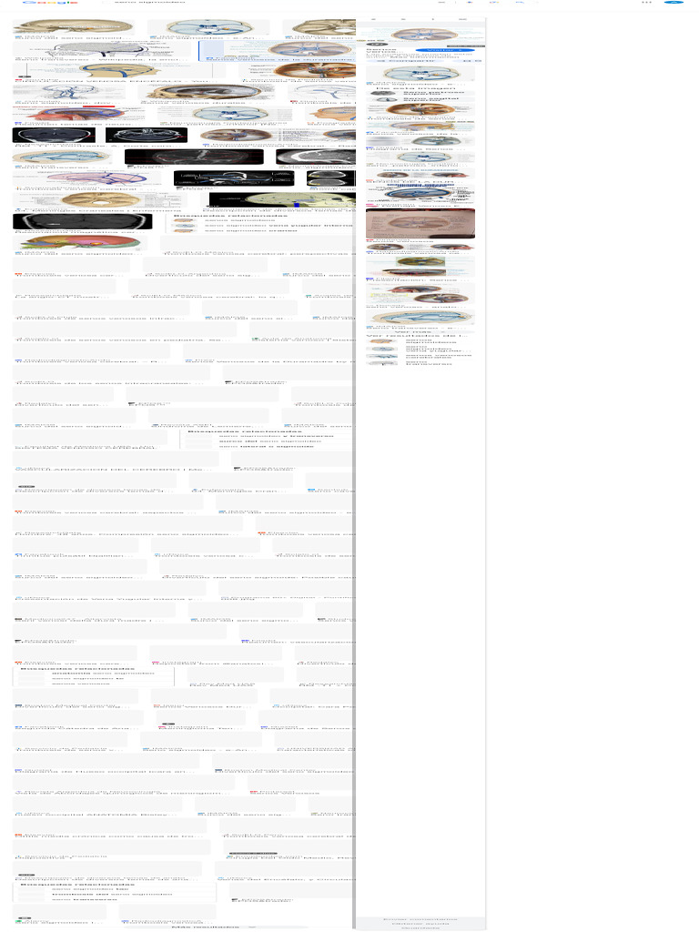Seno Sigmoideo - Buscar Con Google | PDF | Cabeza y cuello humanos