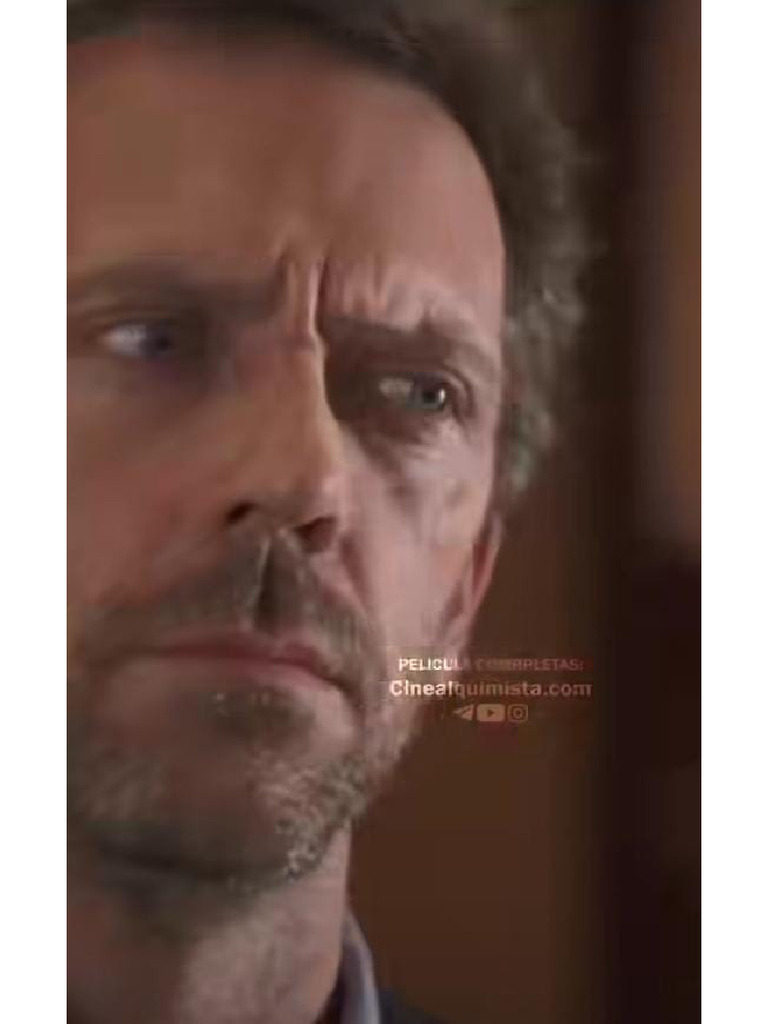 No Es Lopus | PDF