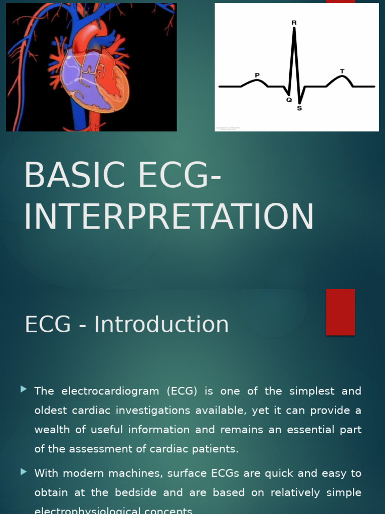 Basic ECG Interpretation | PDF | Electrocardiography | Heart