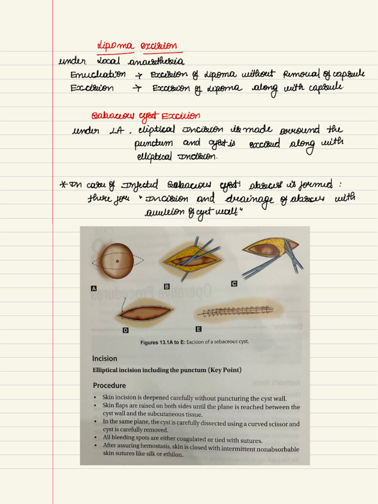 Excision Techniques for Lipomas and Cysts | PDF