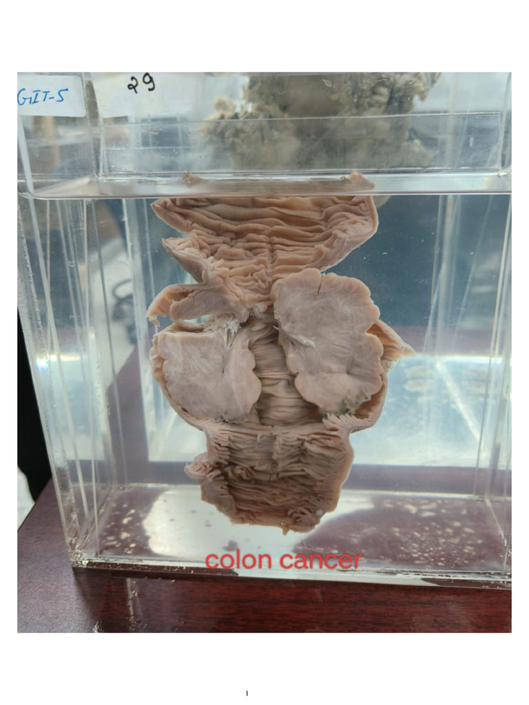 Patho Gross - 231202 - 150521 | PDF