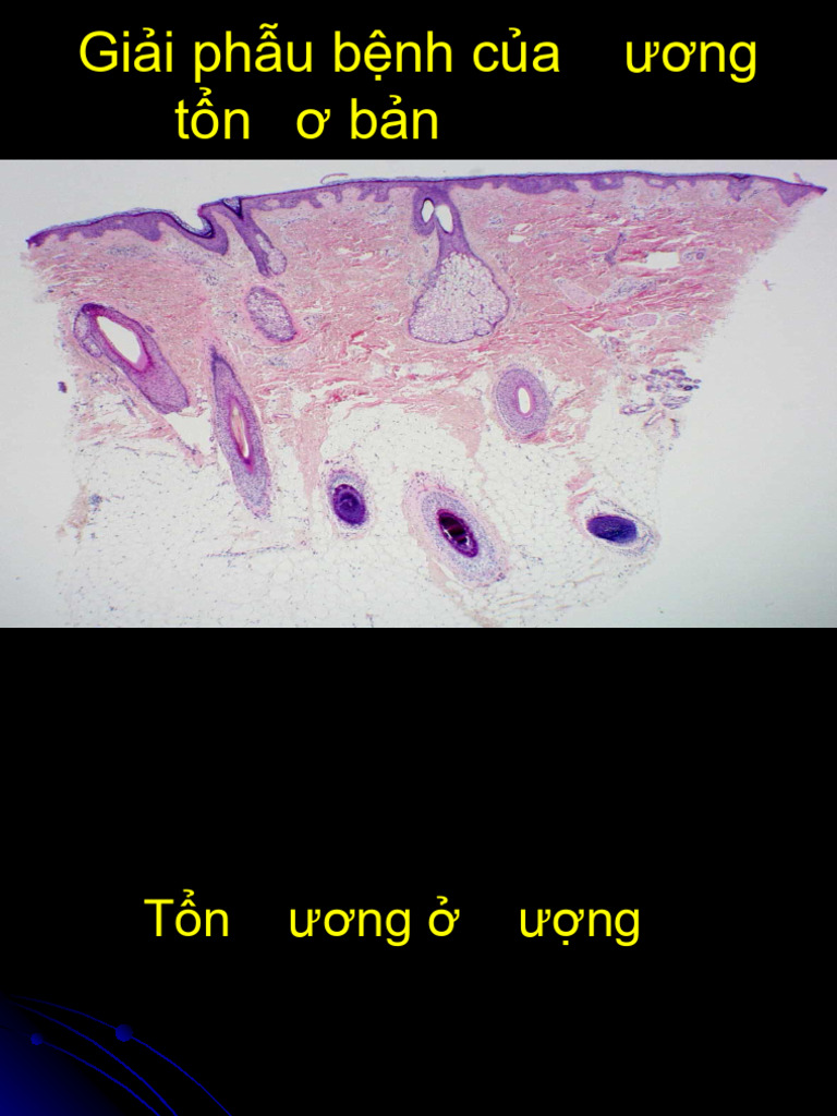 Bài Giảng Thương Tổn Cơ Bản GPB 2025 | PDF