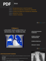 Guía de Signos Radiológicos de Tórax | PDF | Pulmón | Neumonía