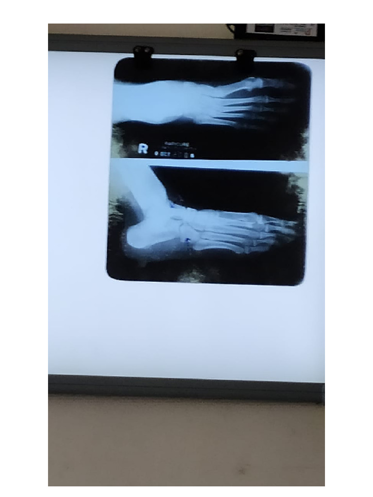 X Ray. Anatomy | PDF