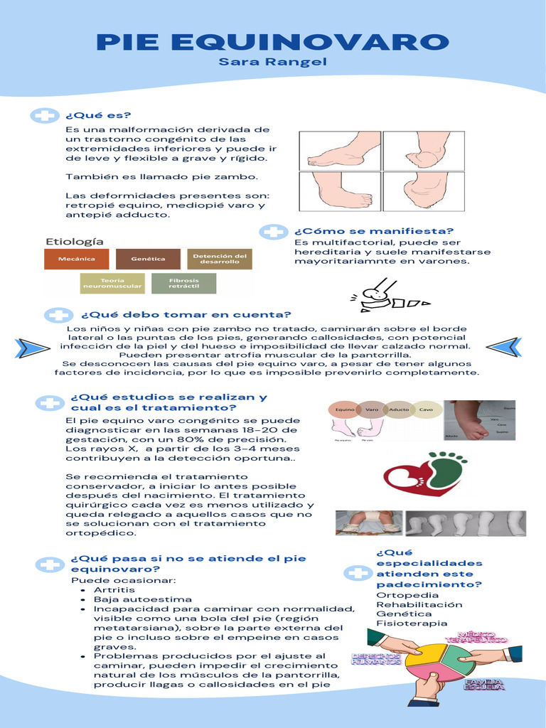 Pie Zambo en Niños: Diagnóstico y Tratamiento | PDF | Pie | Sistema ...