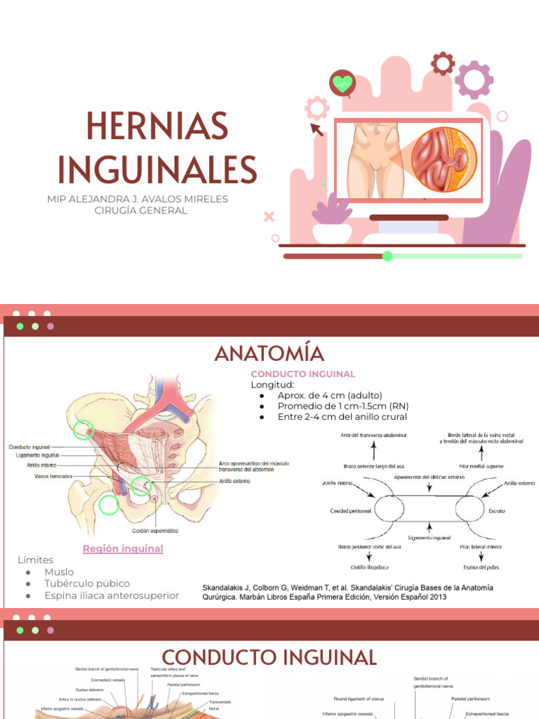 Anatomía y Clasificación de Hernias Inguinales | PDF | Abdomen | Tejido ...