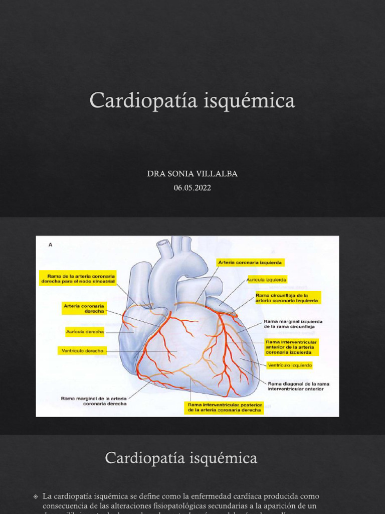 Cardiopatía Isquémica: Causas y Síntomas | PDF | Isquemia | Corazón