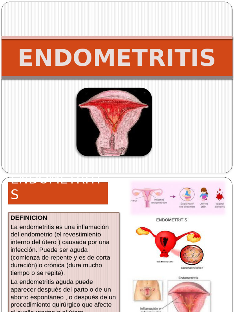 Doxiciclina en el tratamiento de endometritis | PDF | Ginecología ...