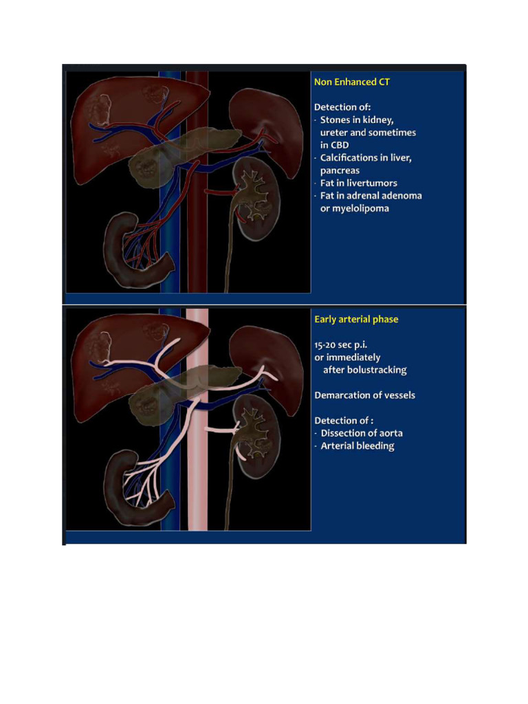 Stages of Triphasic CT Enhancement | PDF