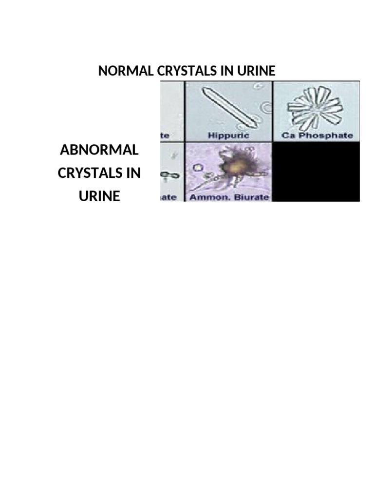 Urine Crystals | PDF