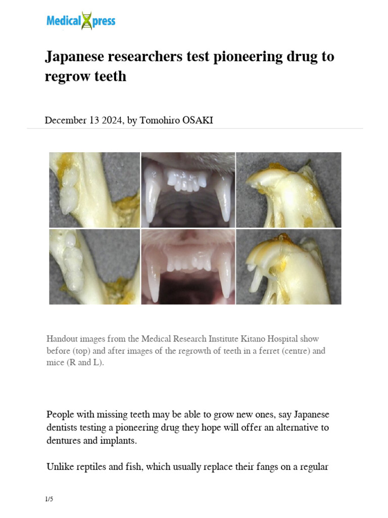 2024 12 Japanese Drug Regrow Teeth | PDF | Dentistry | Tooth