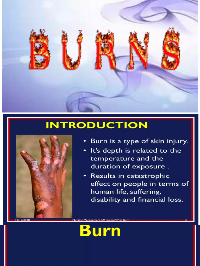 Burns and Its Management | PDF