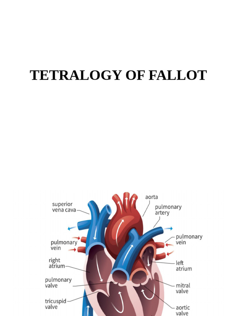 Tetralogy of Fallot | PDF | Congenital Heart Defect | Diseases And ...