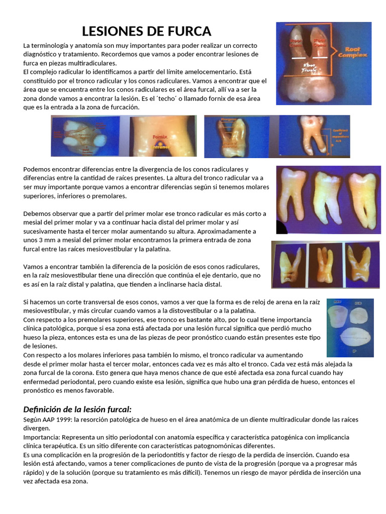 Lesiones de Furca en Dientes Multiradiculares | PDF | Hueso ...