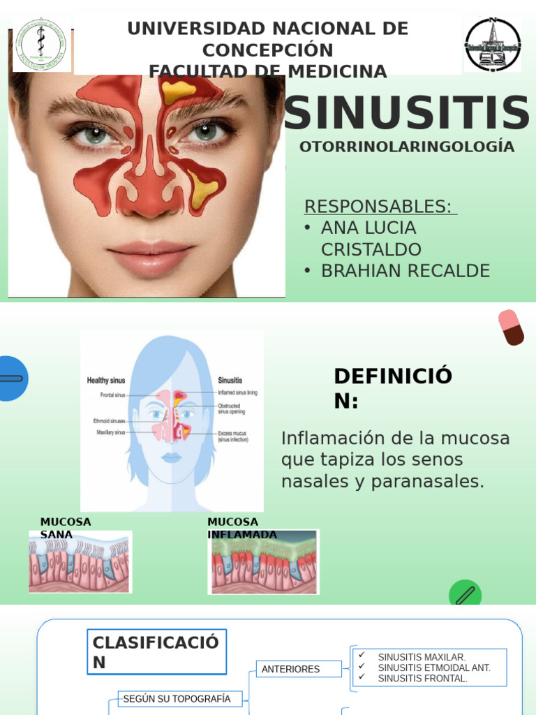 Clasificación y Tratamiento de Sinusitis | PDF | Inmunología | Medicina ...