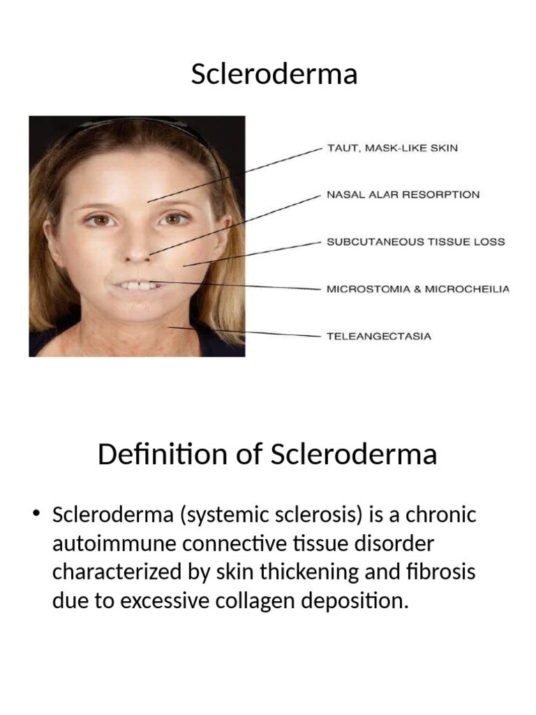 Scleroderma Presentation | PDF | Medical Specialties | Human Diseases And Disorders