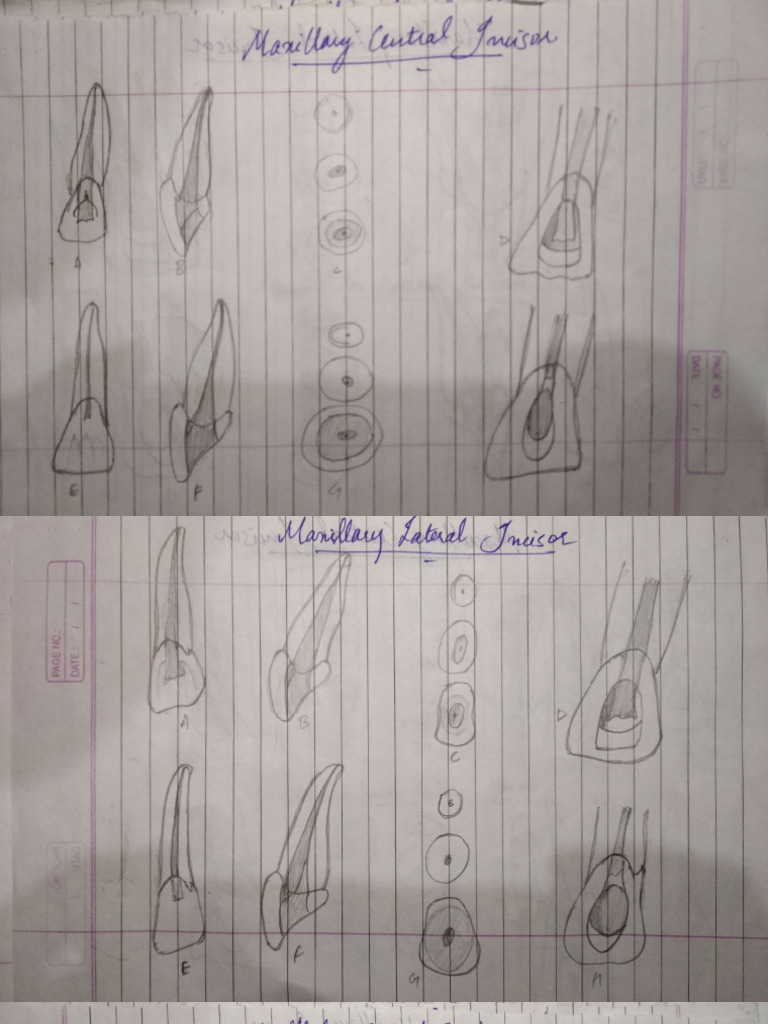 4218 Access Tooth Preparation Diagram | PDF