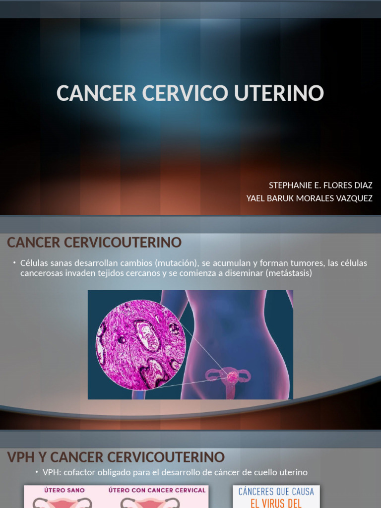 Cancer Cervico Uterino | PDF