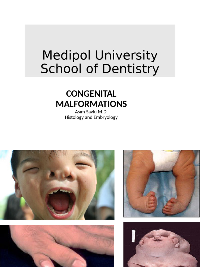 Congenital Malformations | PDF | Ploidy | Genetics