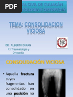 Placa Philos Técnica Cirúrgica | PDF | Tornillo | Cirugía