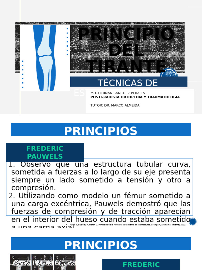 Principio Biomecánico del Tirante | PDF | Hueso | Traumatologia