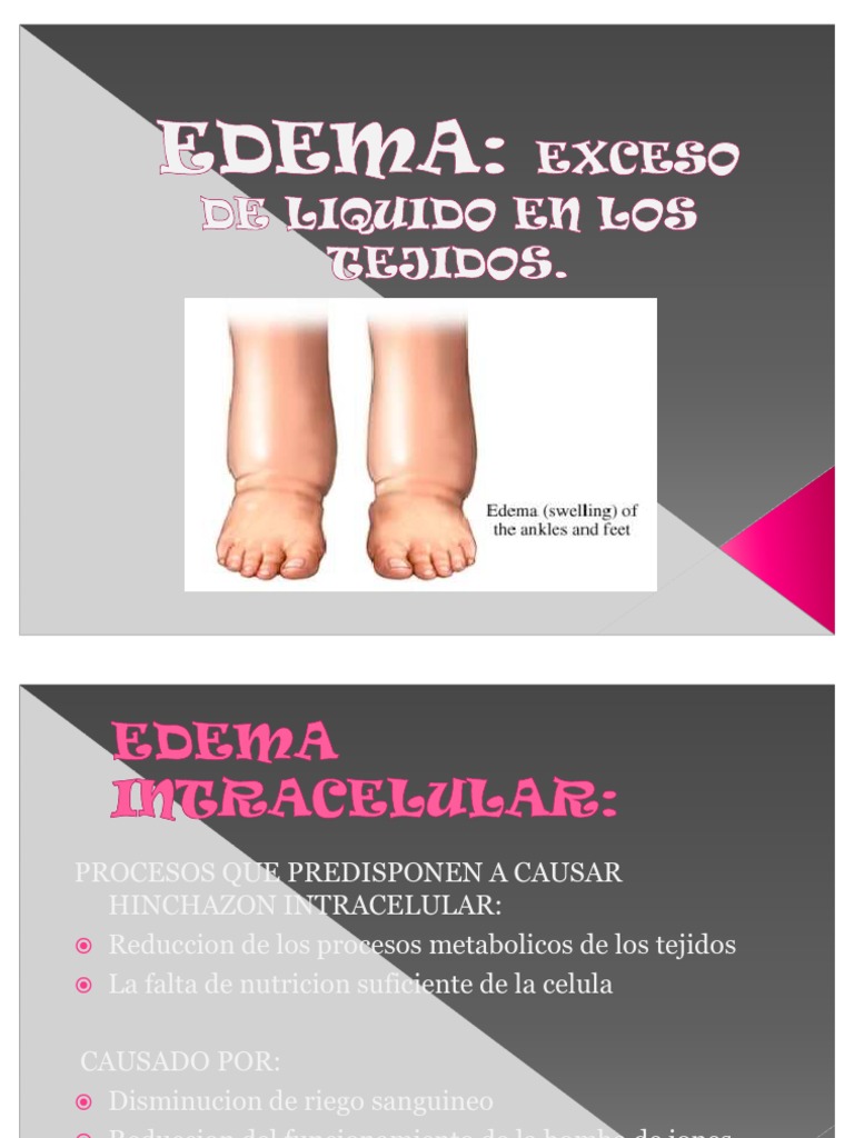 Edema Fisiologia 100303145326 Phpapp01 | PDF | Edema | Medicina