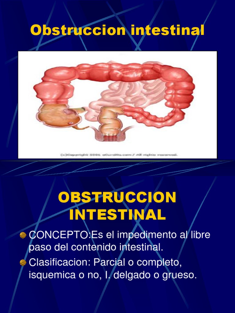 Obstrucción Intestinal: Causas y Tratamiento | PDF