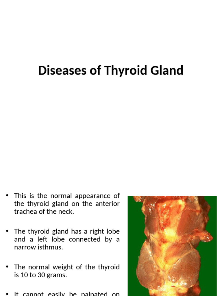 Diseases of Thyroid Gland | PDF | Thyroid | Hyperthyroidism