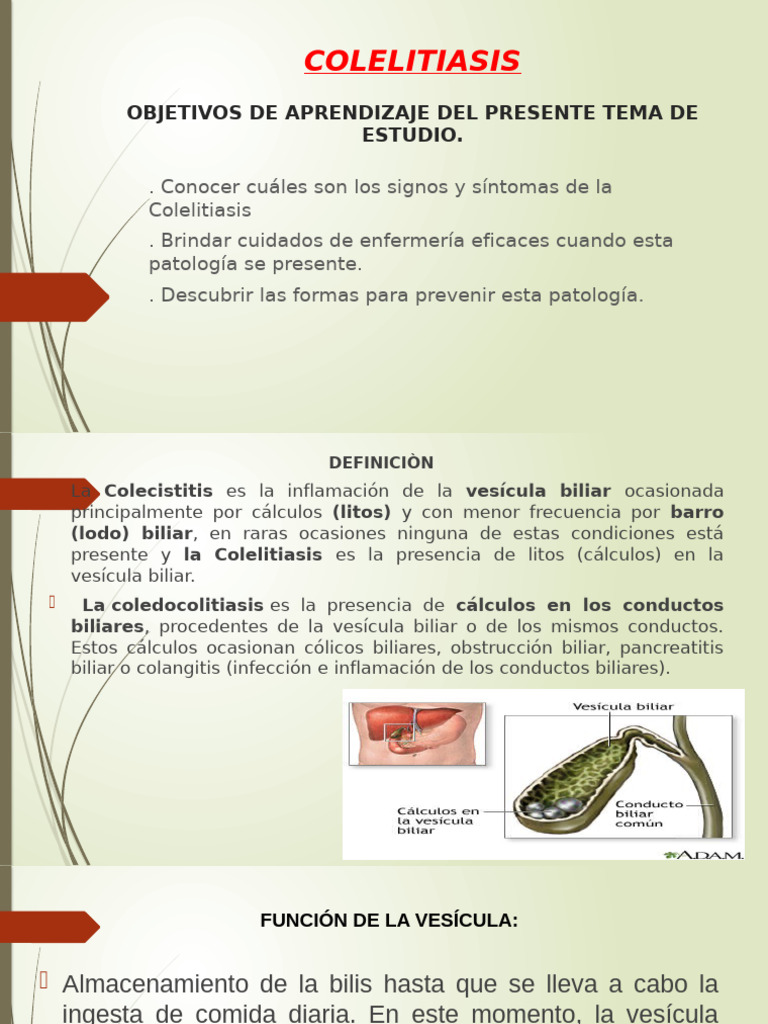 2 Colecistitis y Colelitiasis | PDF | Bilis | Vesícula biliar